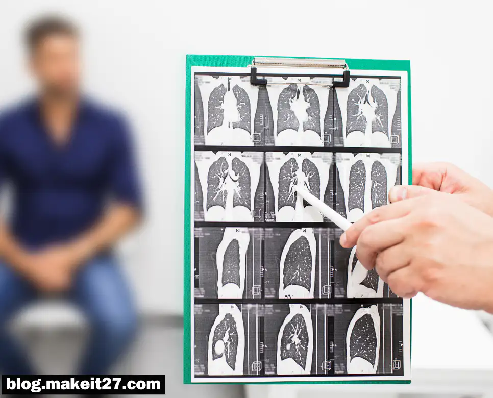 의학용어 GGN, BPH, GFS - 블로그잇27