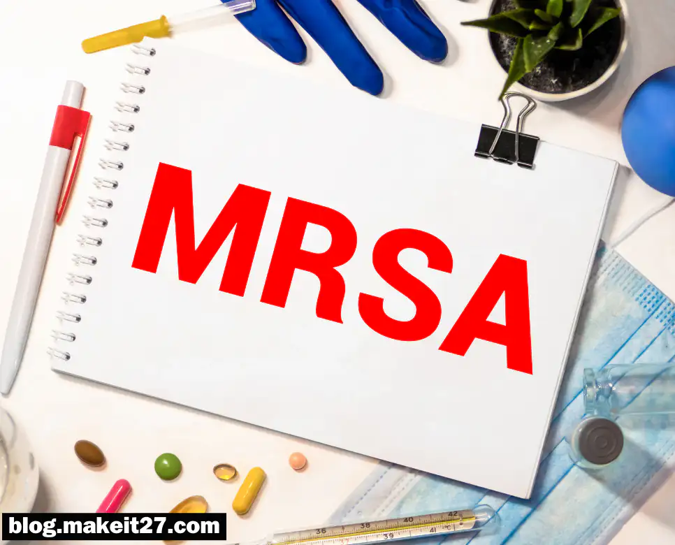 의학용어 MRSA, MD, MRCP - 블로그잇27